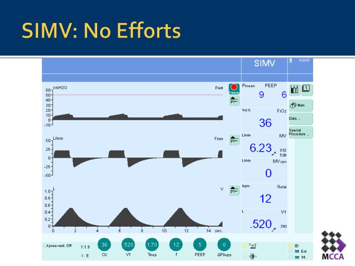 PPT - Synchronized Intermittent Mandatory Ventilation: SIMV PowerPoint ...