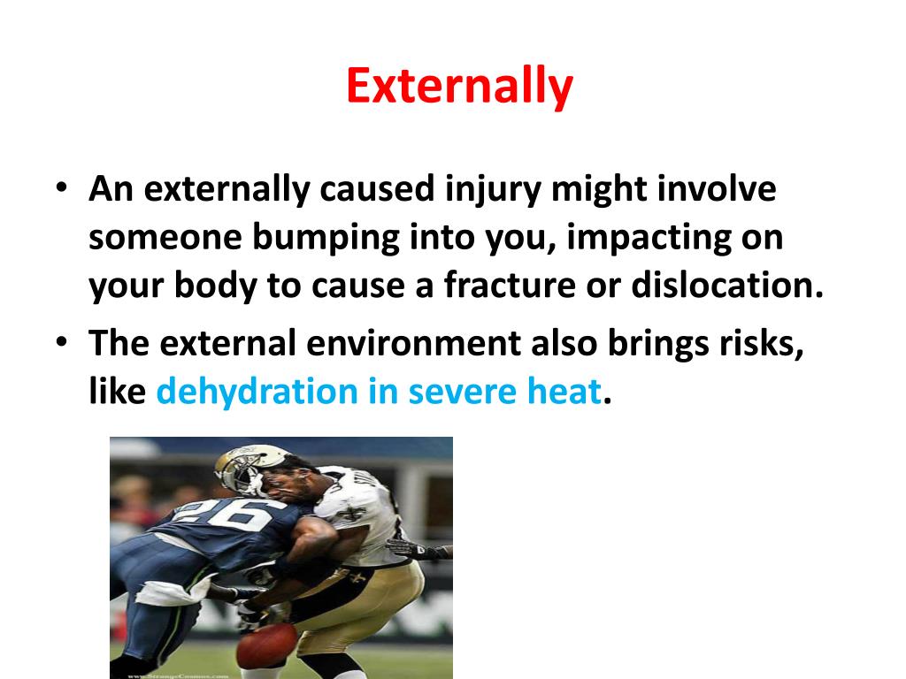 PPT - Year 11 GCSE PE Sports Injuries PowerPoint Presentation, free ...