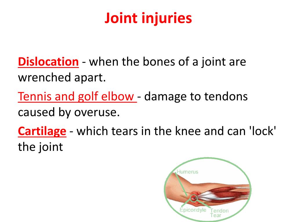 PPT - Year 11 GCSE PE Sports Injuries PowerPoint Presentation, free ...