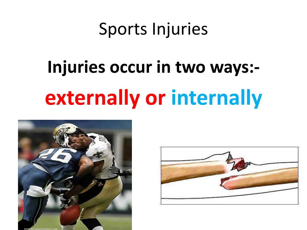 PPT - Year 11 GCSE PE Sports Injuries PowerPoint Presentation, free ... PPT - Year 11 GCSE PE Sports Injuries PowerPoint Presentation, free ...