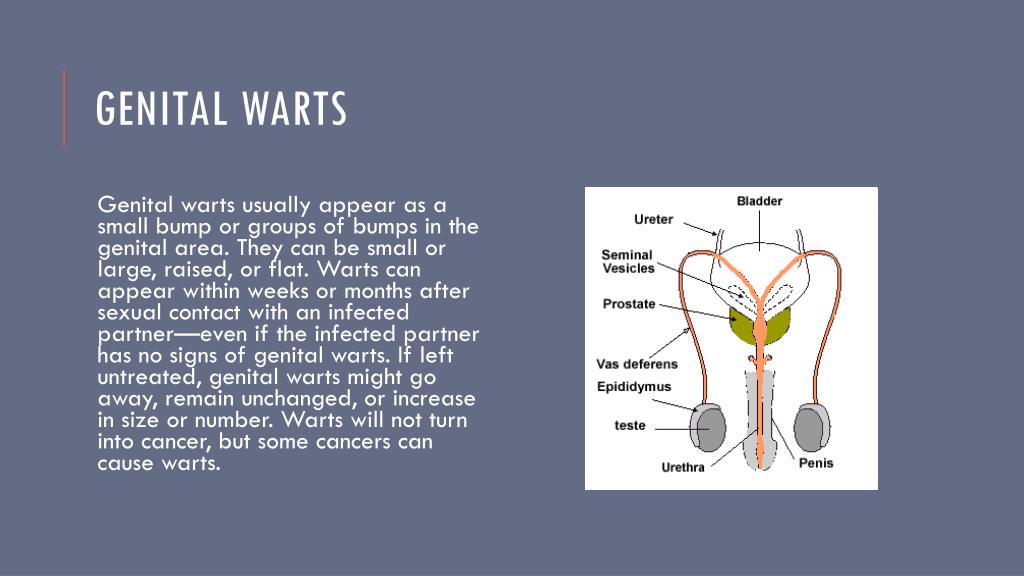 Ppt Hpv Genital Warts Cancer Powerpoint Presentation Free Download