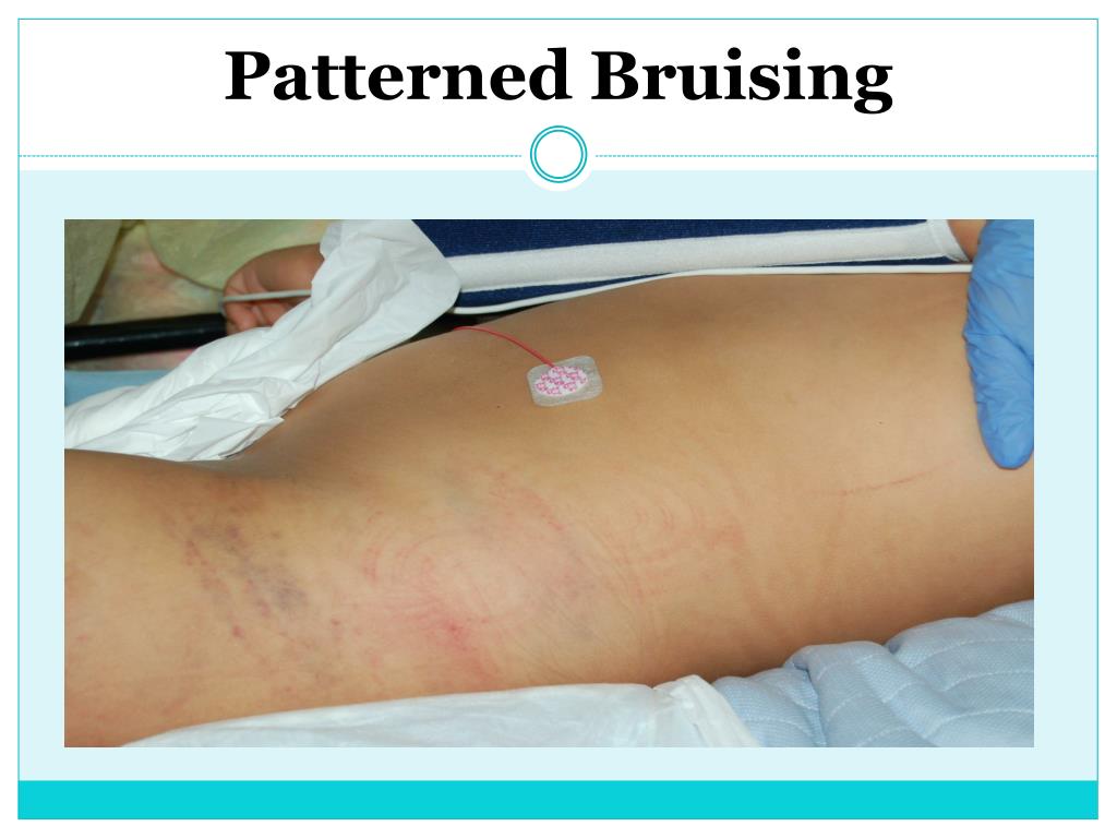 PPT - California Mandated Reporter Training PowerPoint Presentation ...