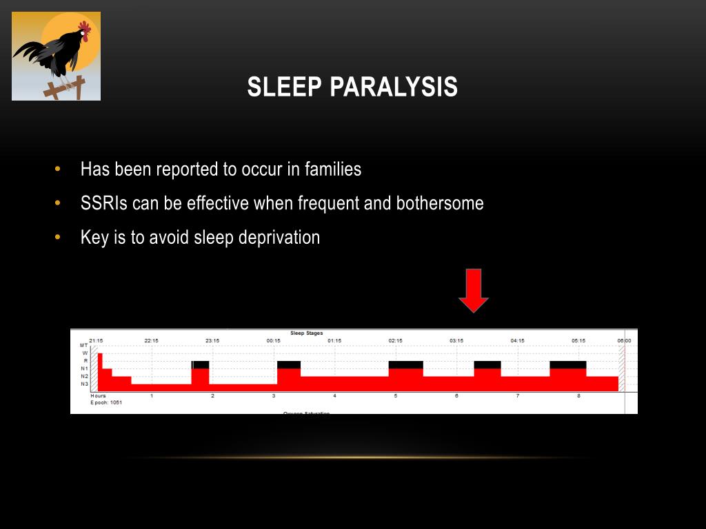 Ppt Parasomnias And Sleep Related Movement Disorders Powerpoint