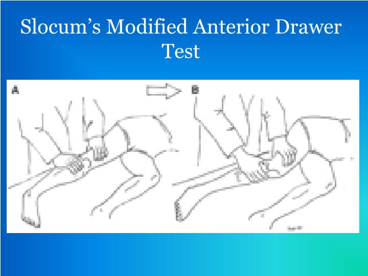 PPT - Medial Collateral Ligament (MCL) Tear PowerPoint Presentation ...