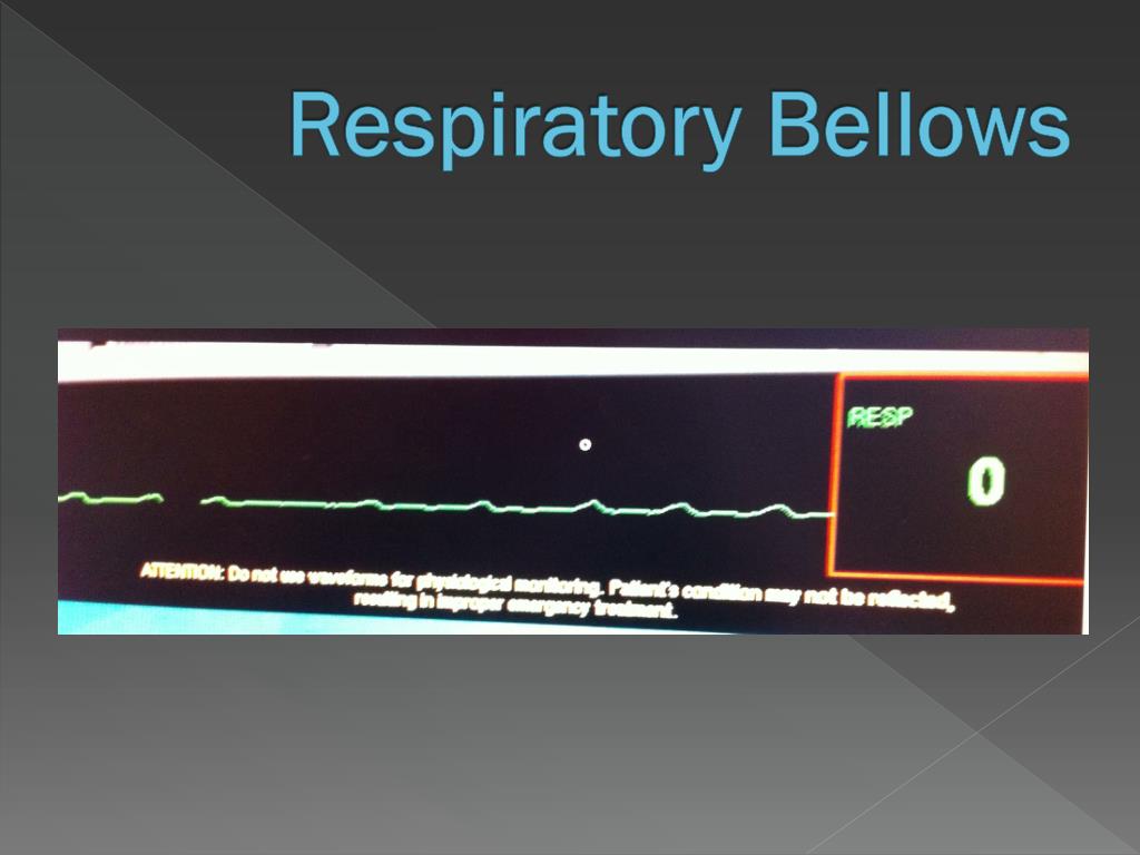 PPT - BROOKLYN 3 MRI USER GROUP Sarah GREEN PowerPoint Presentation ...