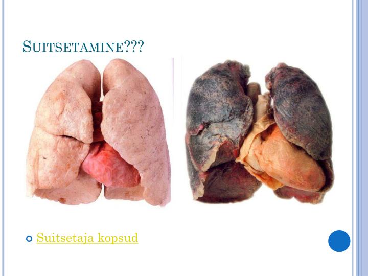 PPT - Hingamiselundkond PowerPoint Presentation - ID:2462844