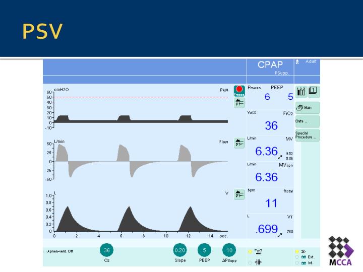 PPT - CPAP/PSV PowerPoint Presentation - ID:2462851