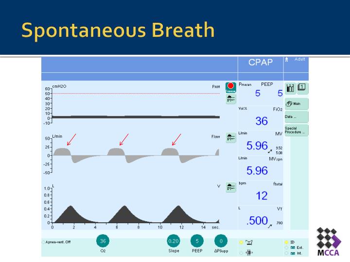 PPT - CPAP/PSV PowerPoint Presentation - ID:2462851