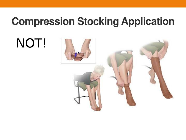 PPT - Venous Stasis Management and Ulcer Healing PowerPoint ...