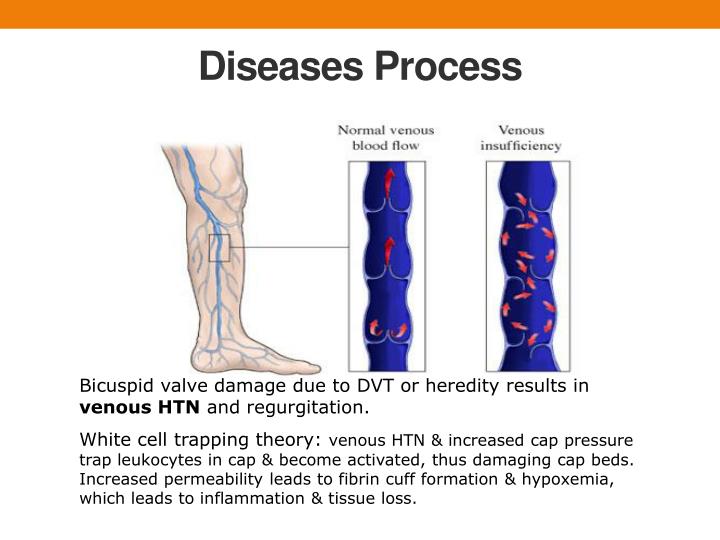 PPT - Venous Stasis Management and Ulcer Healing PowerPoint ...