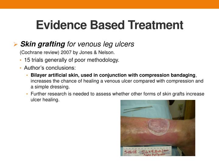 PPT - Venous Stasis Management and Ulcer Healing PowerPoint ...