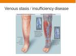 PPT - Venous Stasis Management and Ulcer Healing PowerPoint ...
