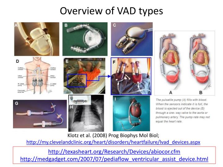 PPT - Ventricular Assist Devices PowerPoint Presentation - ID:2468093