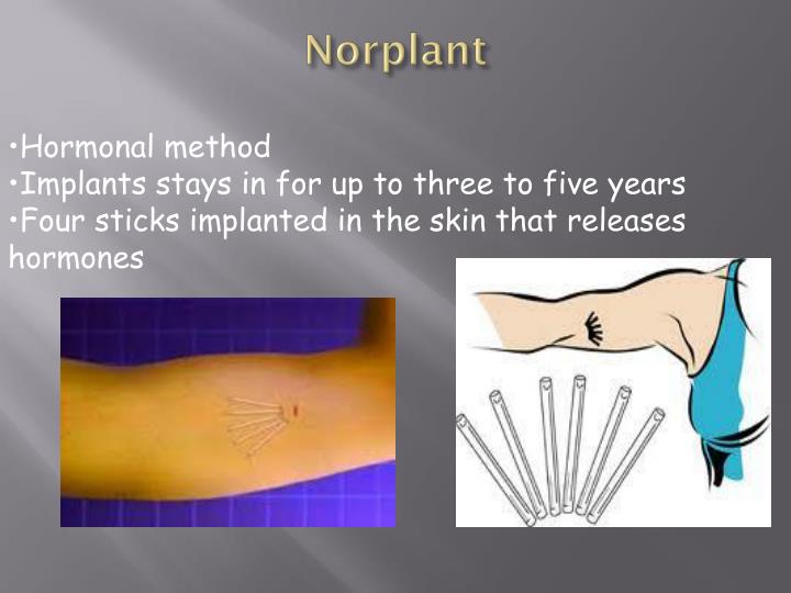 PPT - Birth Control Methods PowerPoint Presentation - ID:2469440