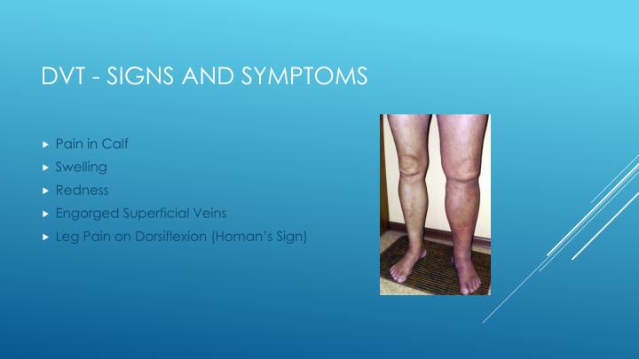PPT - DVT & PE PowerPoint Presentation - ID:2469937