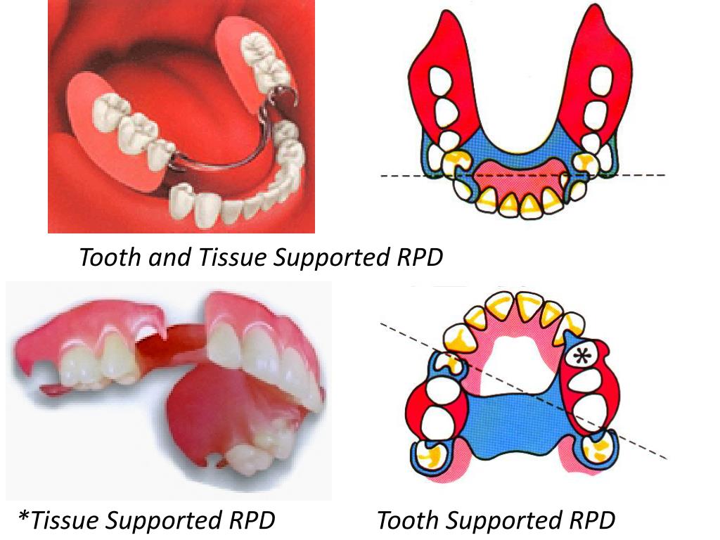 PPT - Introduction to R.P.D PowerPoint Presentation, free download - ID ...