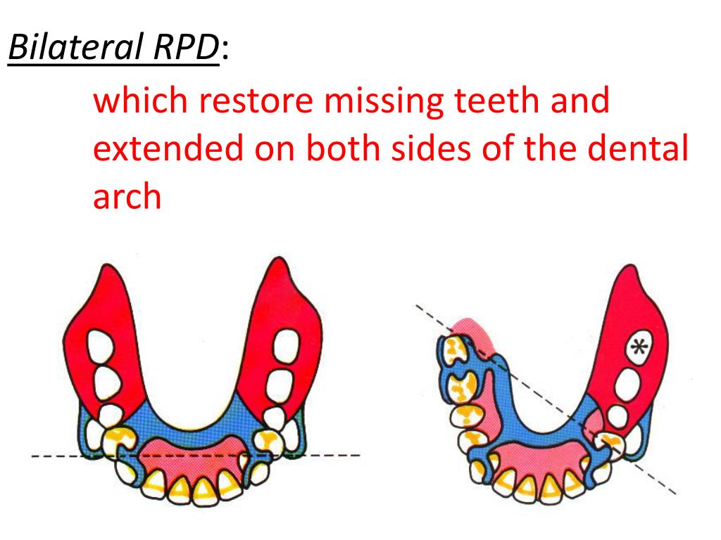PPT - Introduction to R.P.D PowerPoint Presentation, free download - ID ...