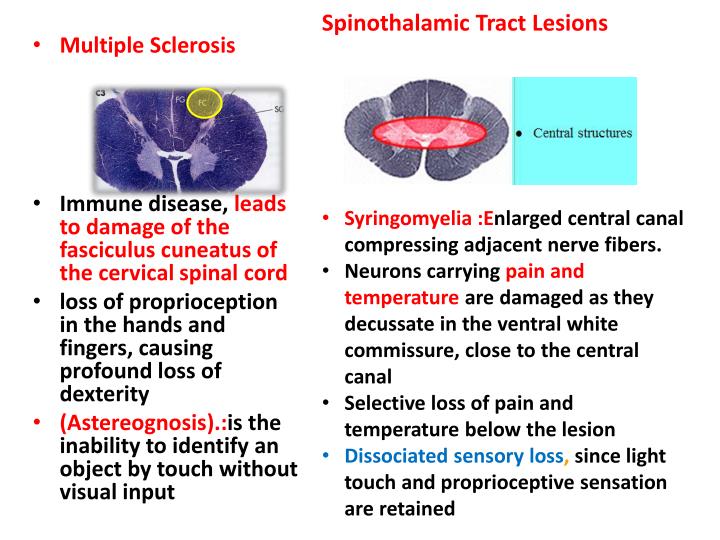 PPT - Descending Tracts PowerPoint Presentation - ID:2474027