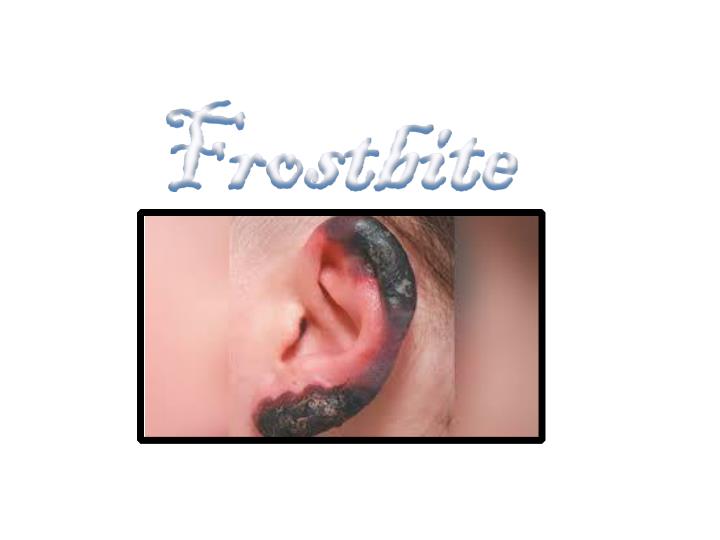 PPT - Cold Weather Safety Tips PowerPoint Presentation - ID:2479582