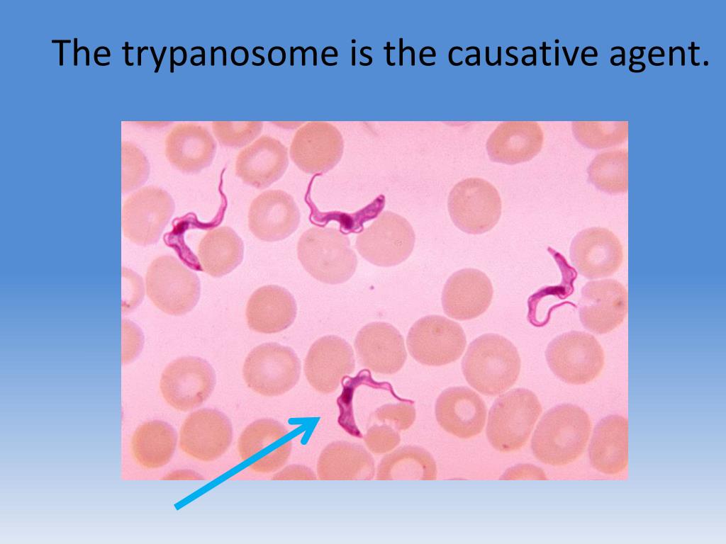 PPT - Sleeping sickness (Human African Trypanosomiasis ) PowerPoint ...