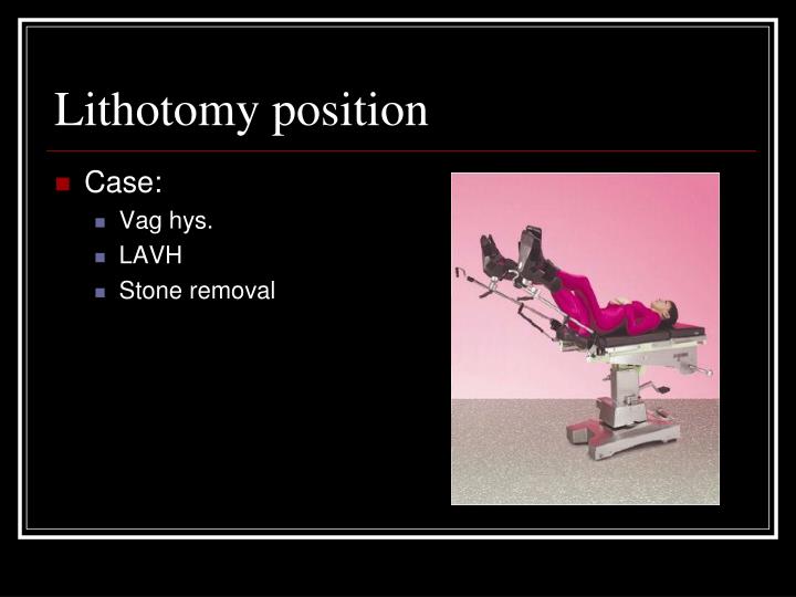 PPT - Principals of Draping PowerPoint Presentation - ID:2486556