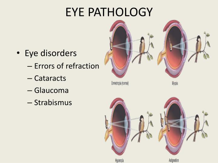 PPT - EENT aka Opthalmology , Otorhinolaryngology PowerPoint ...