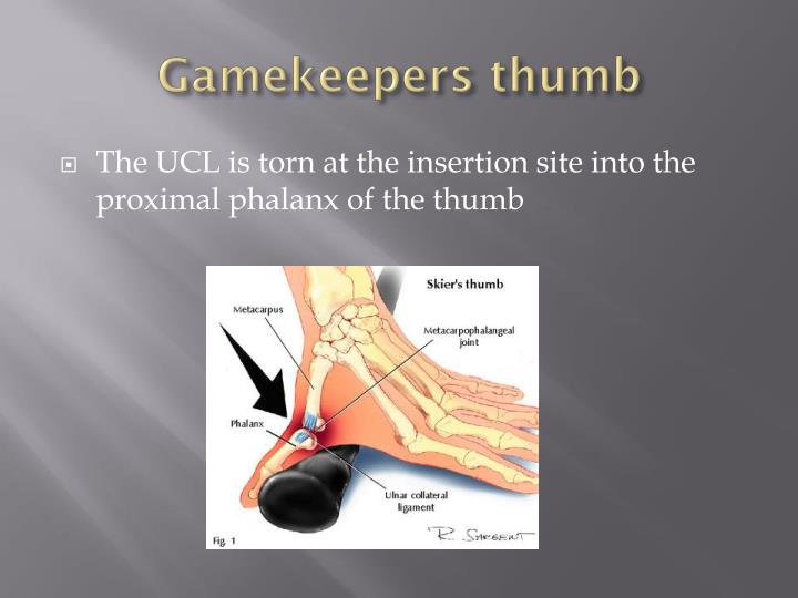 PPT - Gamekeepers thumb PowerPoint Presentation - ID:2491696