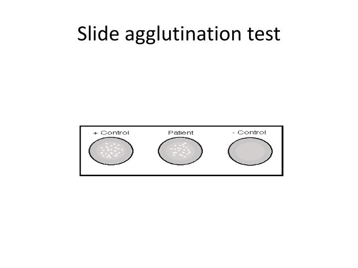 PPT - Antigen antibody reactions PowerPoint Presentation - ID:2494521