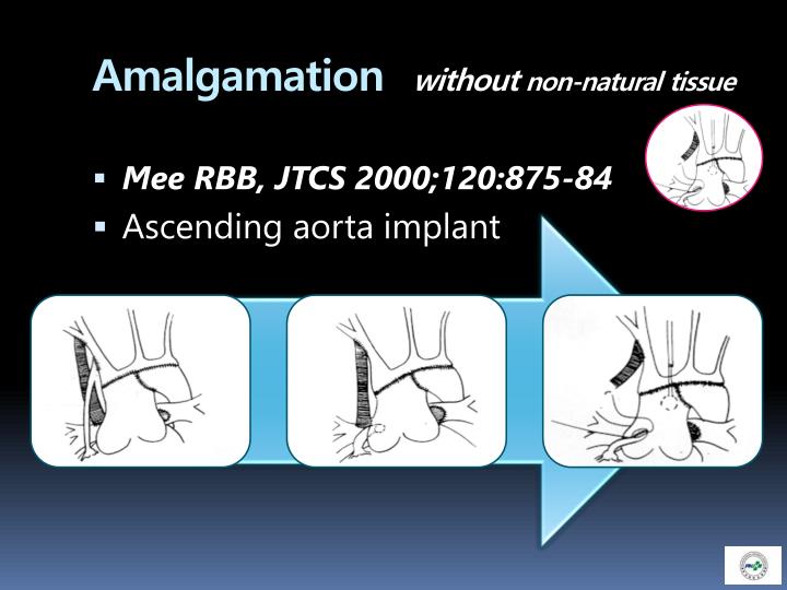 PPT - Damus -Kaye- Stansel & Norwood , as procedures . PowerPoint ...