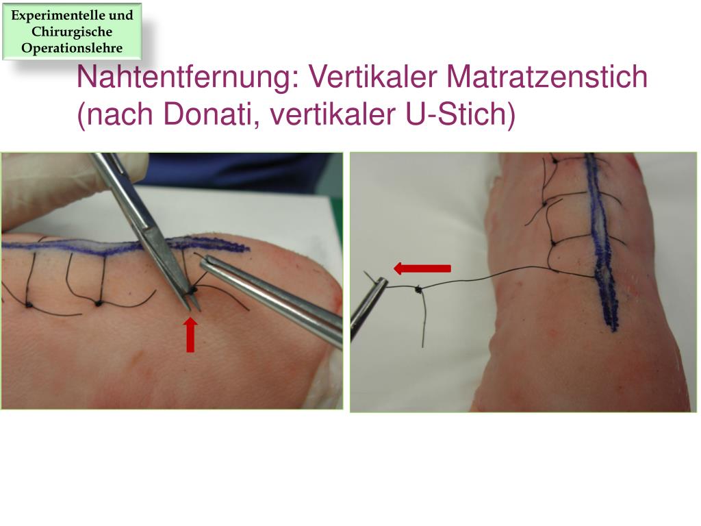 PPT - Zusammenfassung : Knotentechnik und Grundlegende Nahttechniken ...