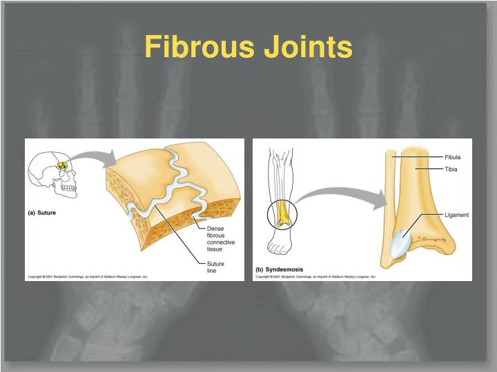PPT - Articulations PowerPoint Presentation - ID:2504118