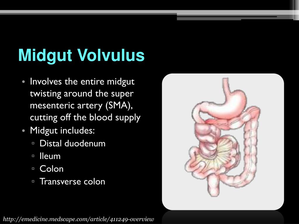 PPT - Nutrition Interventions for Pediatric Patients with Short Bowel ...