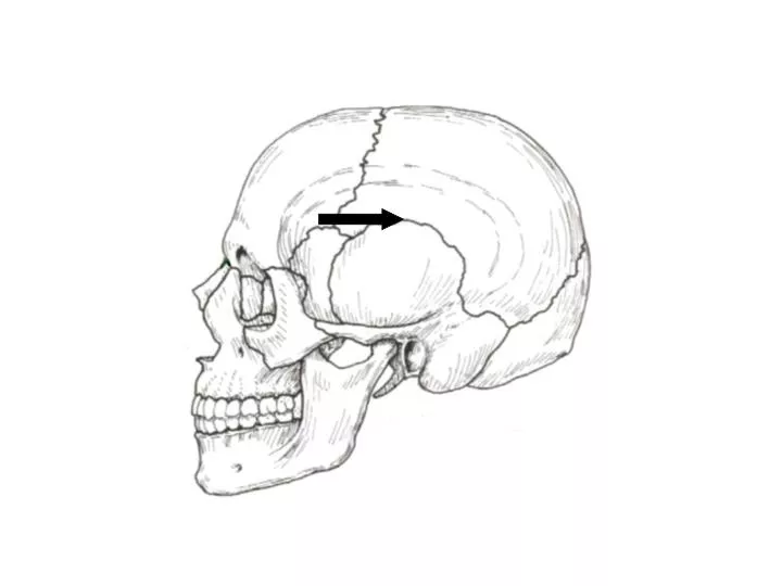 PPT - Squamosal Suture Articulation between Temporal and Parietal Bones ...