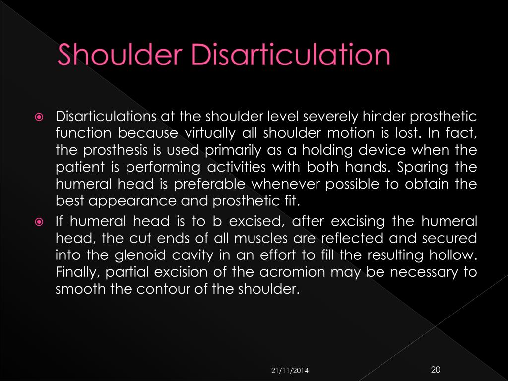 PPT - Siddique Ortho & Rehabilitation Centre PowerPoint Presentation ...