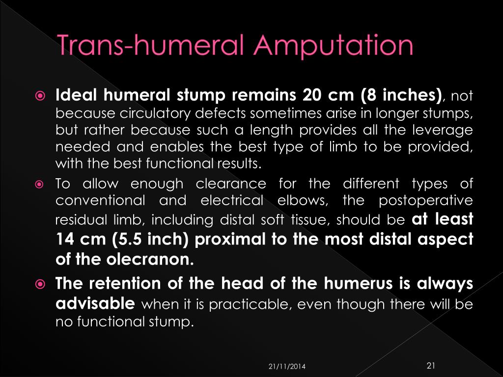 PPT - Siddique Ortho & Rehabilitation Centre PowerPoint Presentation ...