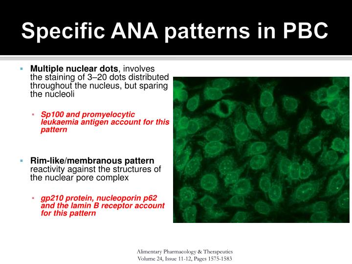 PPT - Autoimmune Liver Disease: an Update on Treatment PowerPoint ...