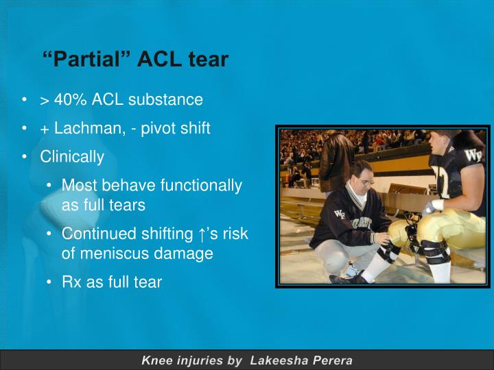 PPT - Knee Ligament Injuries PowerPoint Presentation - ID:2522611