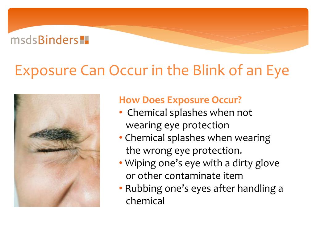 PPT - Eye Health & Safety: Chemical Exposure in the Workplace ...