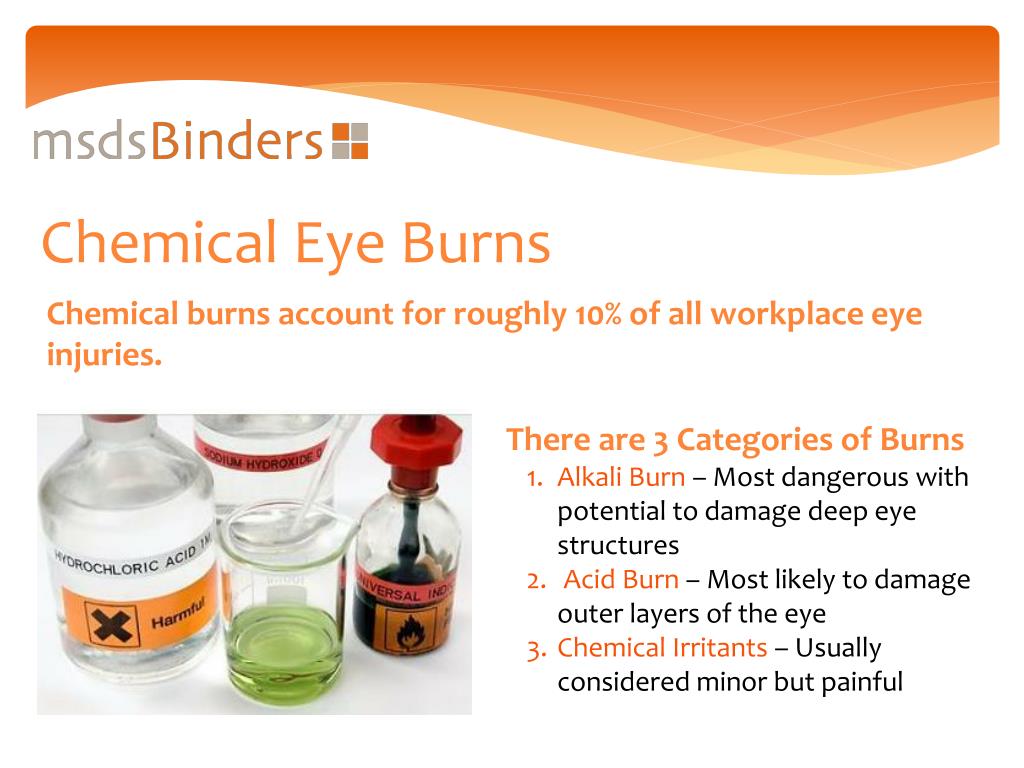 PPT - Eye Health & Safety: Chemical Exposure in the Workplace ...