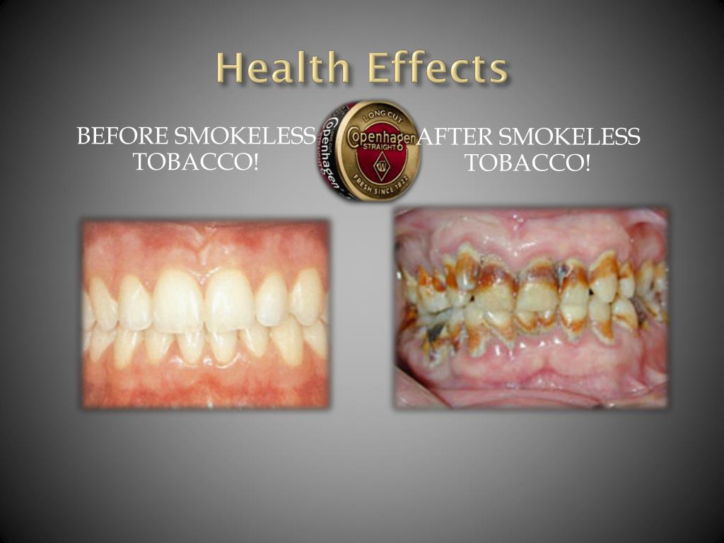 PPT - Cigarette Smoking and Chewing Tobacco PowerPoint Presentation ...