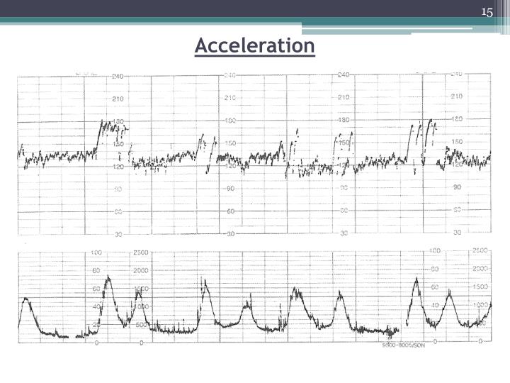 PPT - Calibration of the CTG PowerPoint Presentation - ID:2534045