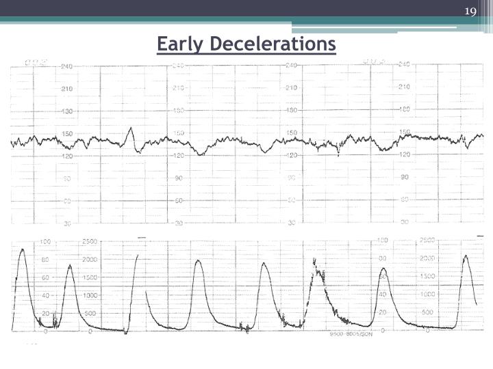 PPT - Calibration of the CTG PowerPoint Presentation - ID:2534045