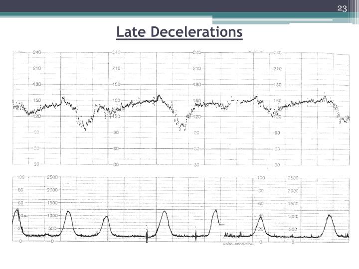 PPT - Calibration of the CTG PowerPoint Presentation - ID:2534045