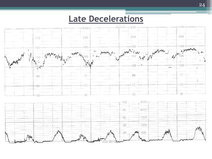 PPT - Calibration of the CTG PowerPoint Presentation - ID:2534045
