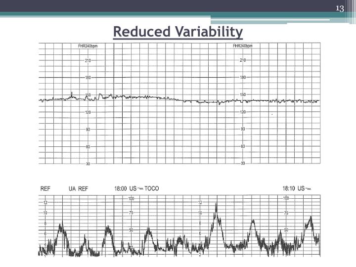 PPT - Calibration of the CTG PowerPoint Presentation - ID:2534045