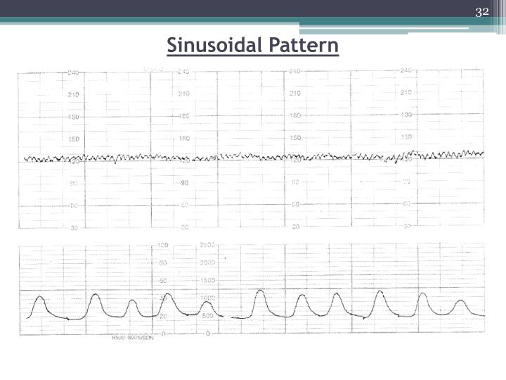PPT - Calibration of the CTG PowerPoint Presentation - ID:2534045