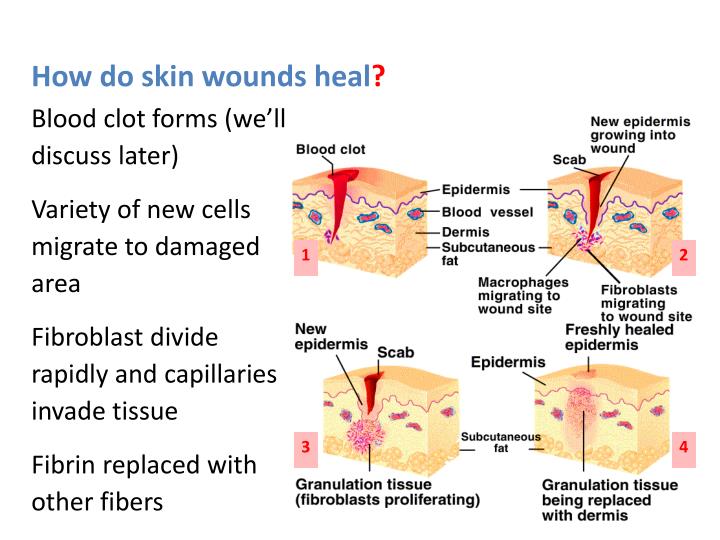 PPT - Abnormal skin colorations: Cyanosis Pallor Jaundice Albinism ...
