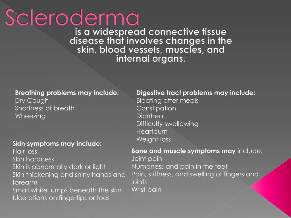 Ppt Scleroderma Powerpoint Presentation Free Download Id 2560585