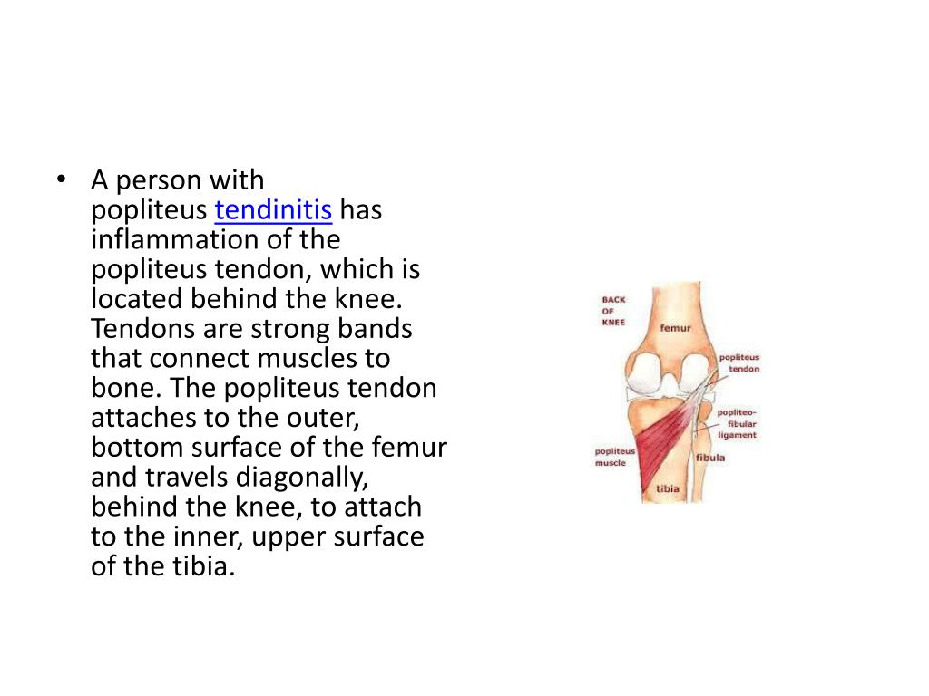 PPT What Is Popliteus Tendinitis PowerPoint Presentation Free PPT What Is Popliteus Tendinitis PowerPoint Presentation Free