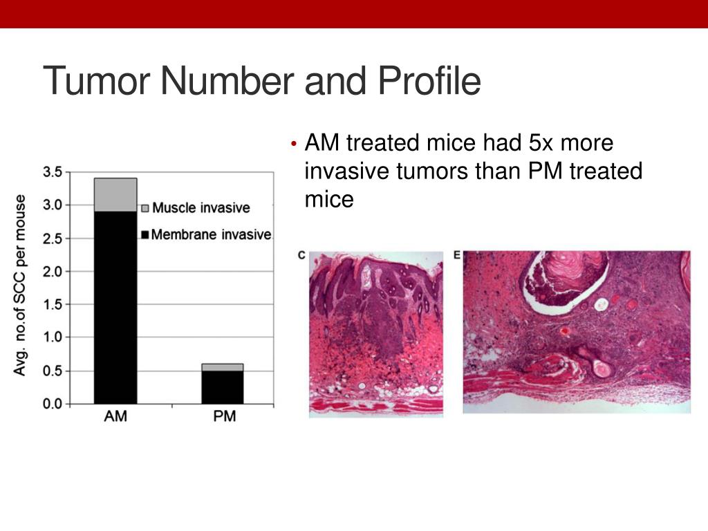 PPT - Control of skin cancer by the circadian rhythm PowerPoint ...